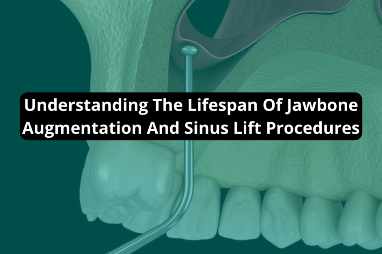Understanding The Lifespan Of Jawbone Augmentation And Sinus Lift Procedures - Advanced ...